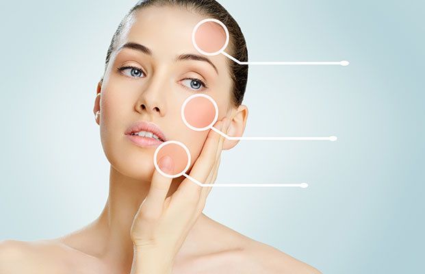 La Rosacée - SANTE+