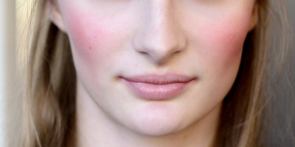 La Rosacée - SANTE+