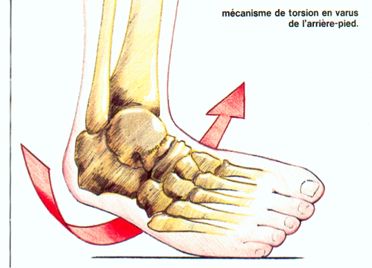 Neymar et l'entorse de cheville . Mise au point par le Dr Gaillaud ...