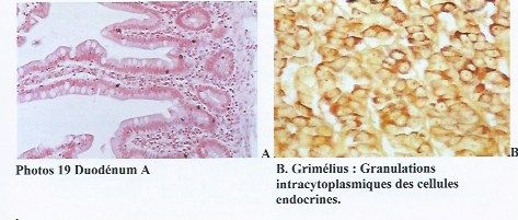 Chapitre XII (suite 6) coloration Grimelius, Grocott - anatomopathologie